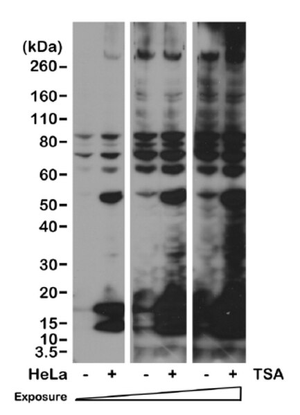 Anti-Acetyl Lysine, Pan, clone RM101 Antibody | MABE1020
